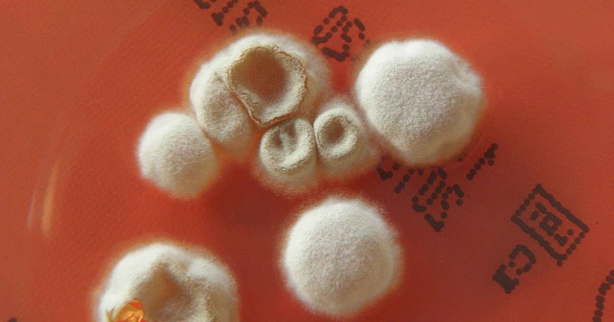 ATLAS MICOLOGIA: EPIDERMOPHYTON FLOCCOSUM (2)