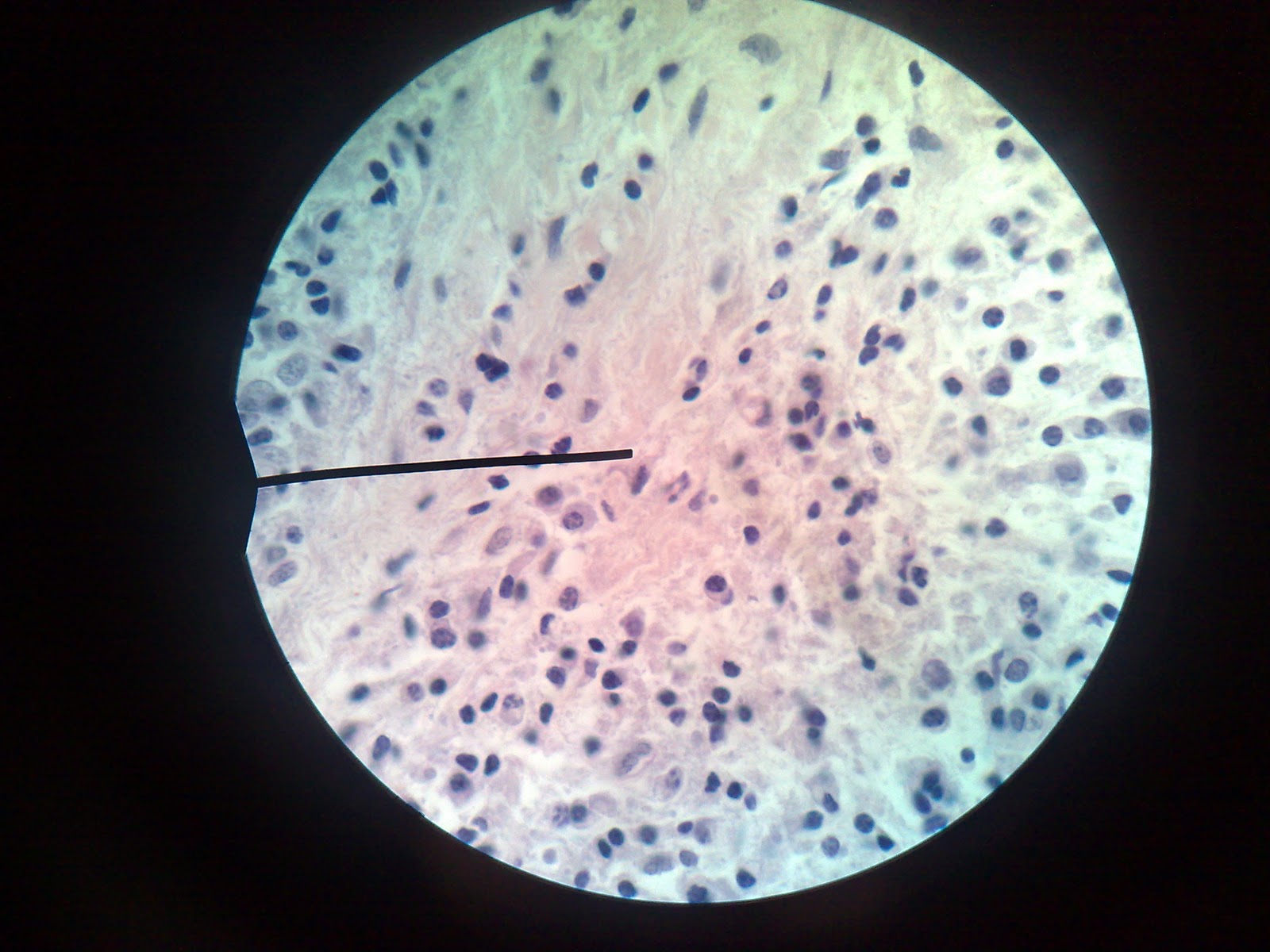 .: Las Laminas!!! \o/