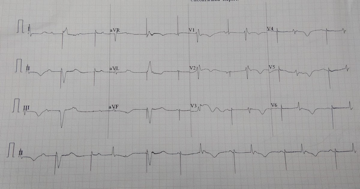 Cardiology window: Pacemaker failure to capture