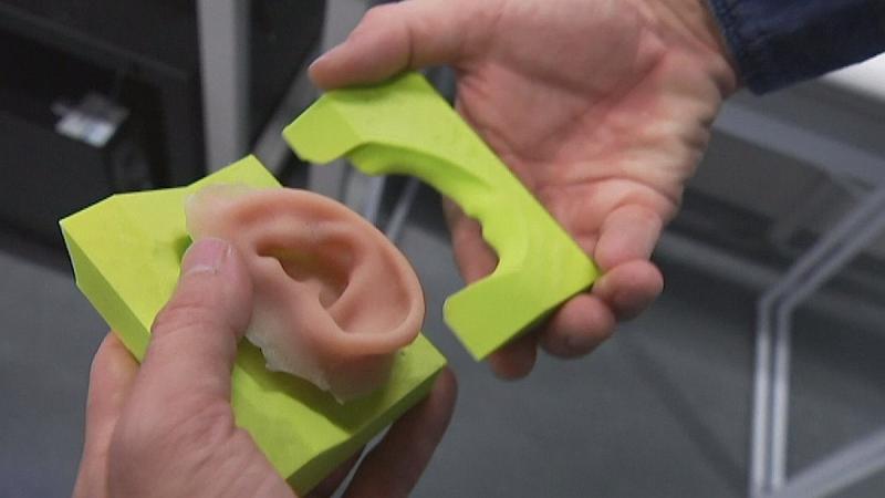 Leisurepit.com: Girl to be fitted with 3D printed ear in Australia