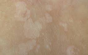 .: Tips Merawat Panau Secara Semulajadi