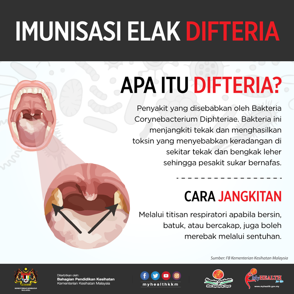 Tanda & Gejala Penyakit Difteria (Februari 2019) | YusufUltraMaN