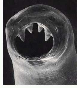 He Set Me Free: Spiritual Parasite Cleanse- Remove the Snakes and Take ...