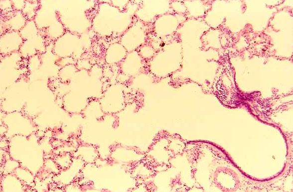 My notes: Its How I graduated Medical School.: Difference between ...