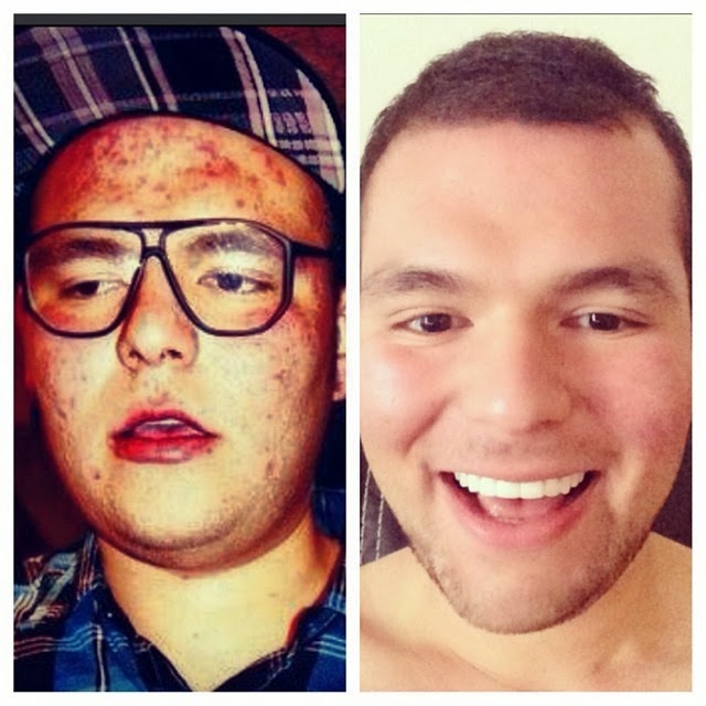 Fitness Transformation Tuesday with The Raw Boy | new