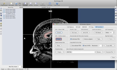 Neuroimaging Made Easy : Brainvoyager QX tips and tricks 2; Create a 3d ...