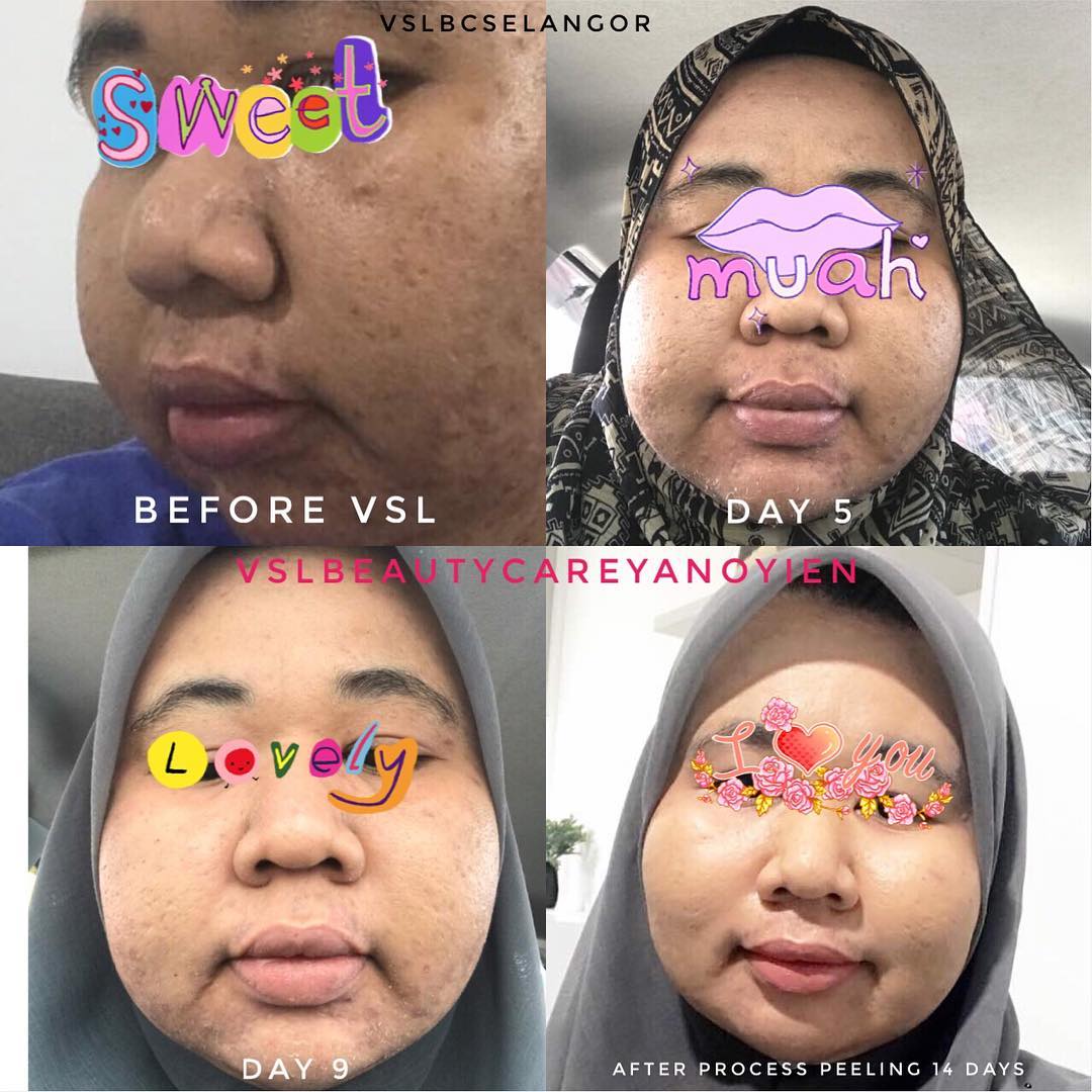 PRODUK PEMUTIH DAN PENGELUPASAN VSL BEAUTY CARE: July 2018
