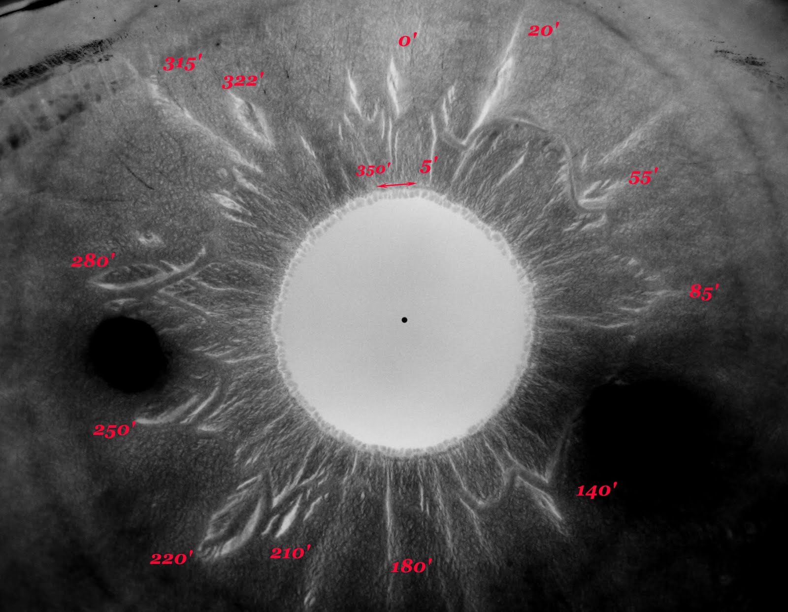 Modern & Multidimensional Iridology: Frontal Pupil Flattening, HPA Axis ...