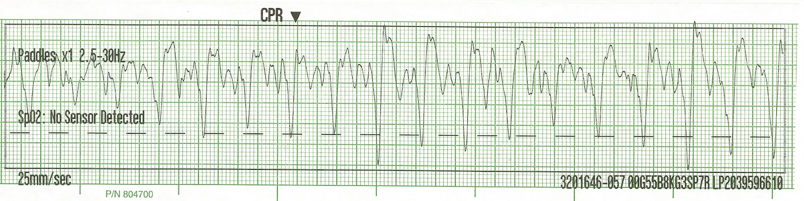 Float Nurse: Code Blue: Cafe Coronary