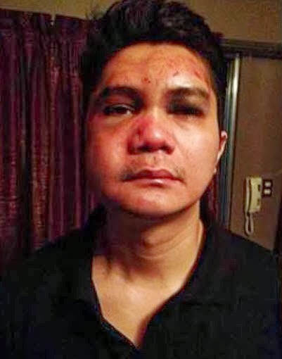 Vhong Navarro Released from Hospital, Files Formal Complaint on DOJ ...