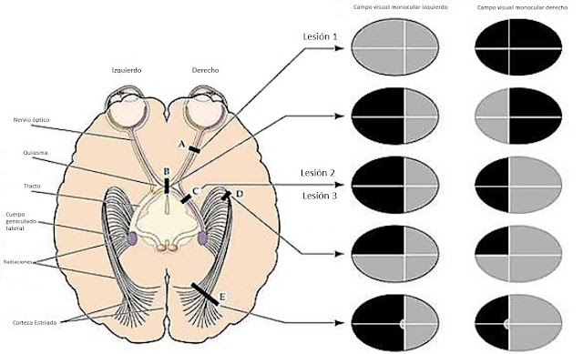 OJO ALÉRGICO, SECO GRAVE Y SJÖGREN: VÍAS VISUALES
