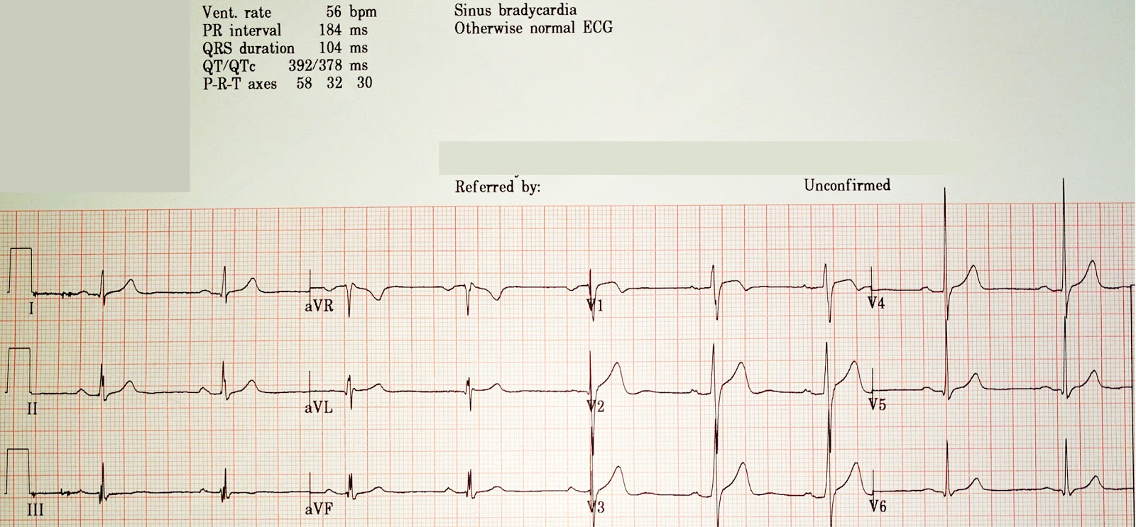 Dr Smiths Ecg Blog