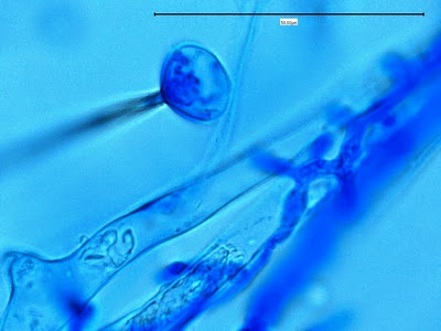 Fun With Microbiology (What's Buggin' You?): Apophysomyces elegans ...