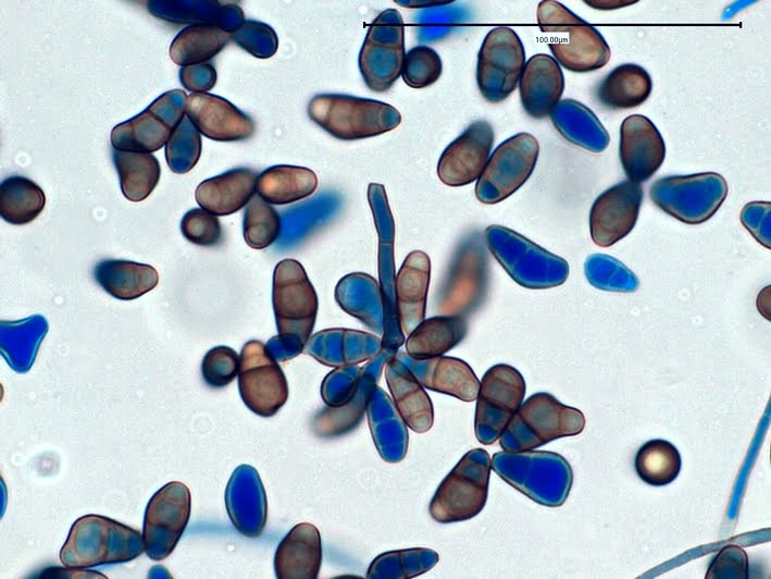 Fun With Microbiology (What's Buggin' You?): Curvularia sp.