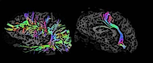 Ann's Autism Blog: Visual Autism and Understanding Language