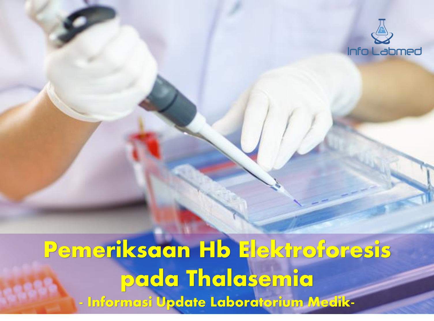 Pemeriksaan Hb Elektroforesis pada Thalasemia - Seri Pemeriksaan Laboratorium Medik