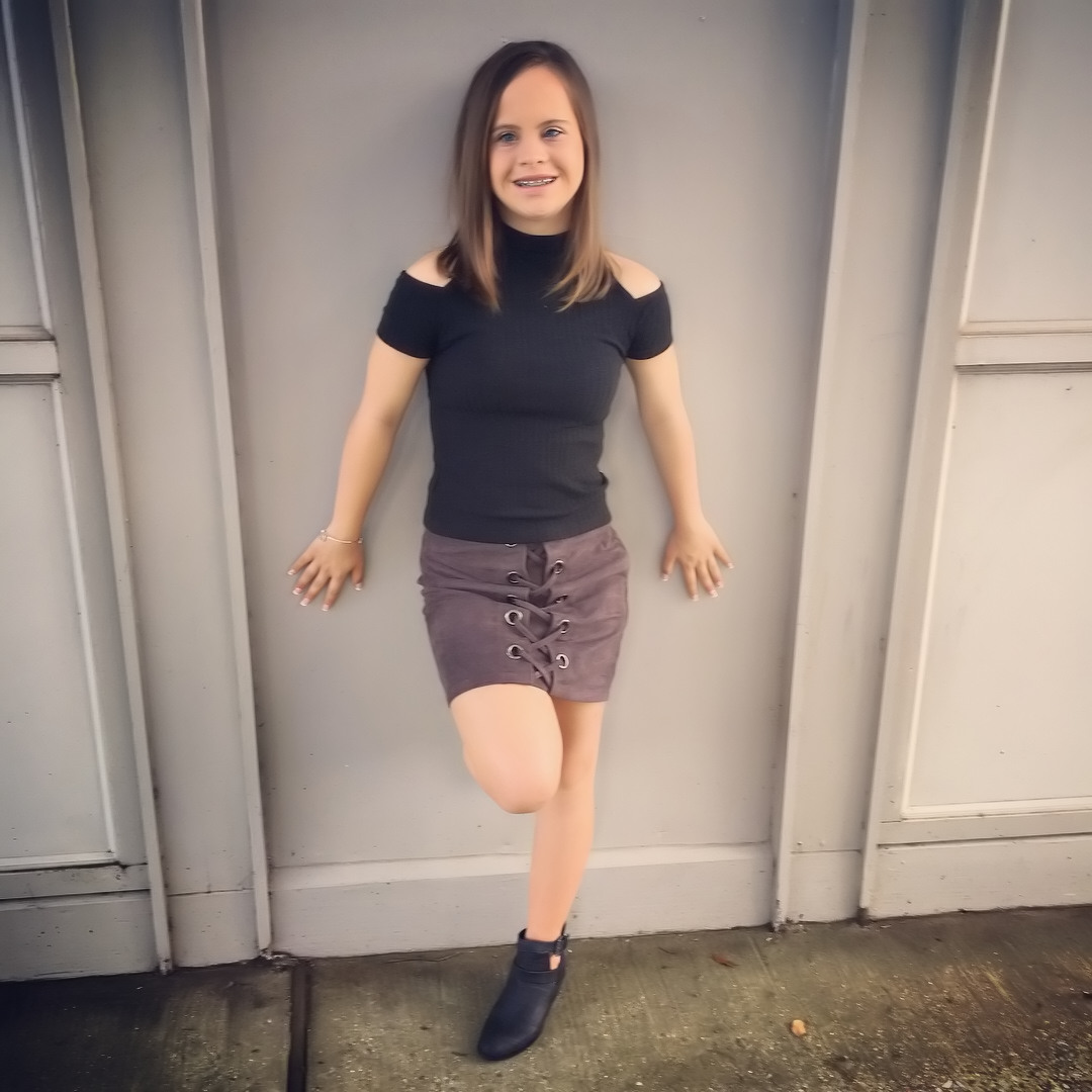 Anna Sikes | Diversity in the Modelling World