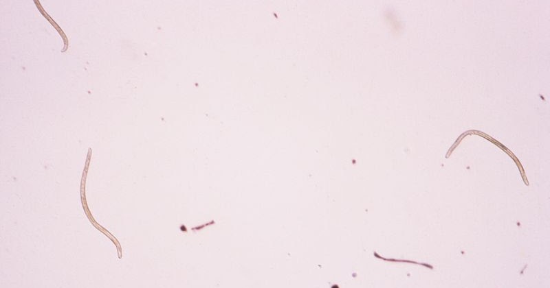 Infection Landscapes: Onchocerciasis