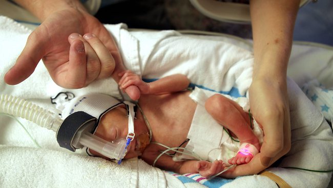Chest Medicine Made Easy Dr Deepu Extremely Premature Infants See chest-medicine-made-easy-dr-deepu-extremely-premature-infants-see