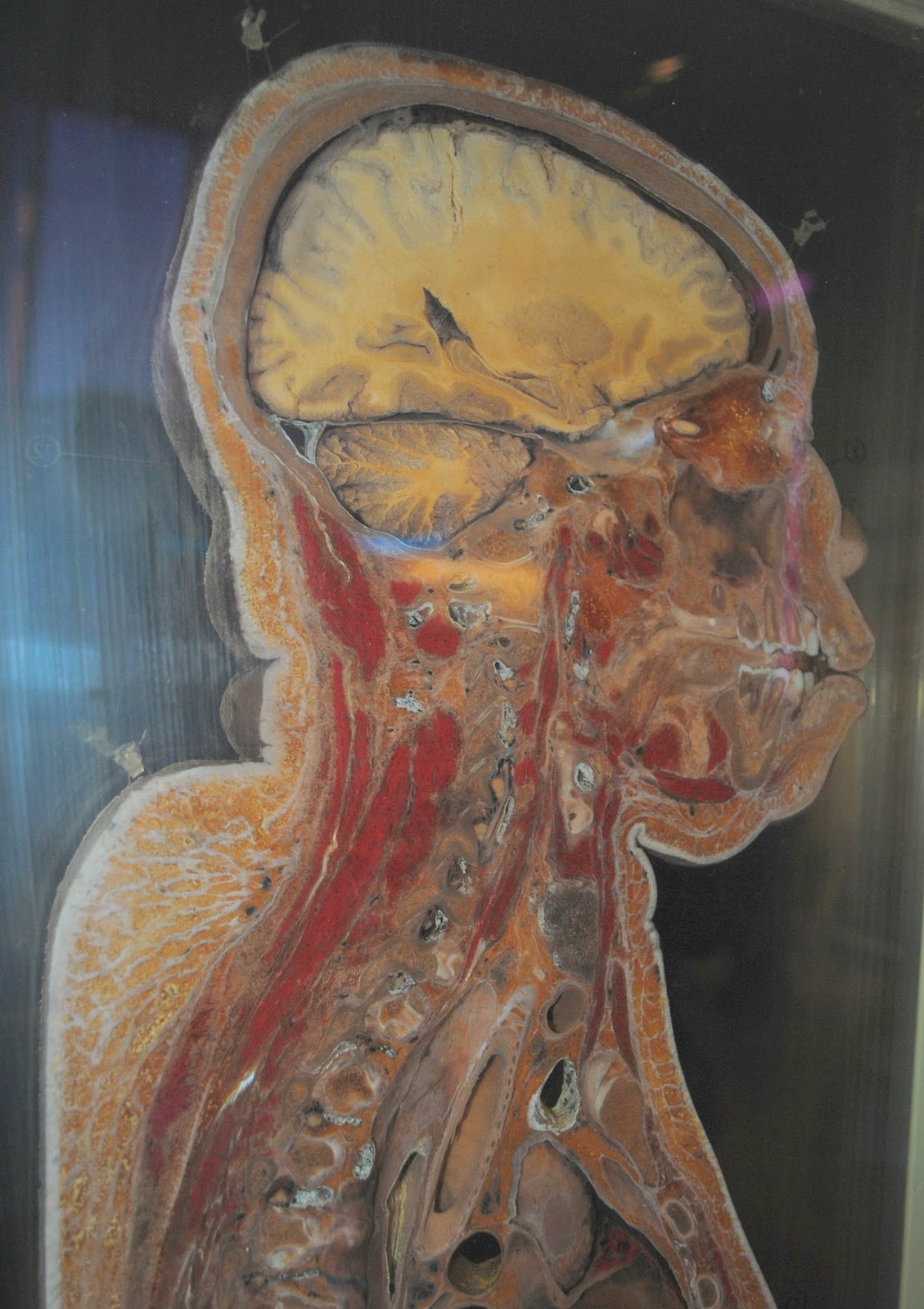 The Carpetbagger: Return of the Body Slices