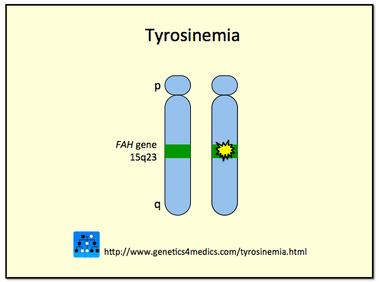 Medical Treatment Pictures-for Better Understanding: Tyrosinemia Type I