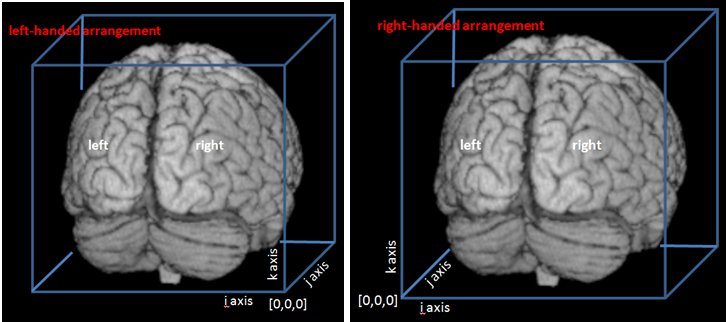 MVPA Meanderings: NIfTI image handedness
