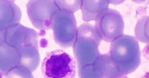 Valores Normales de Leucocitos: Granulocitos Basófilos