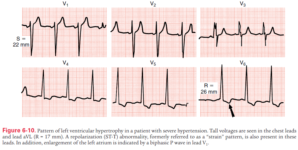 NOTA KEDOKTERAN: Interpretation of ECG (Introduction, Chambers ...