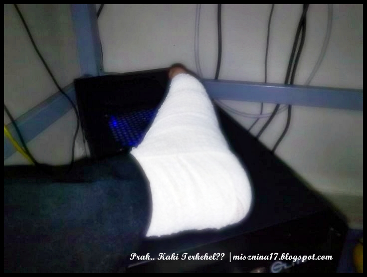 Prak.. Kaki Terkehel?!!
