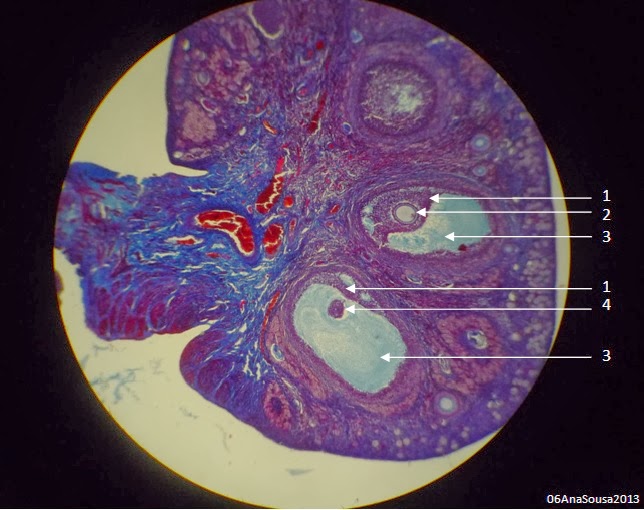 06AnaSousa: Observação de preparações definitivas de gonadas