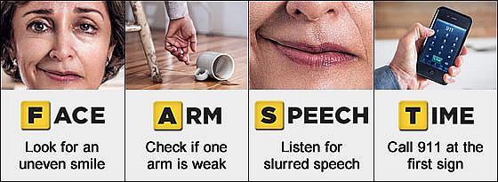 Stronger After Stroke Blog (THE STROKE RECOVERY BLOG): A Problem with ...