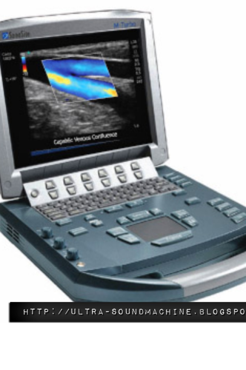 Ultra Sound Machine: Sonosite M-Turbo Ultrasound Machine