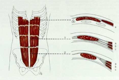 Are you too lazy to live?: Body Posture & Muscles Functions: (Part 7)