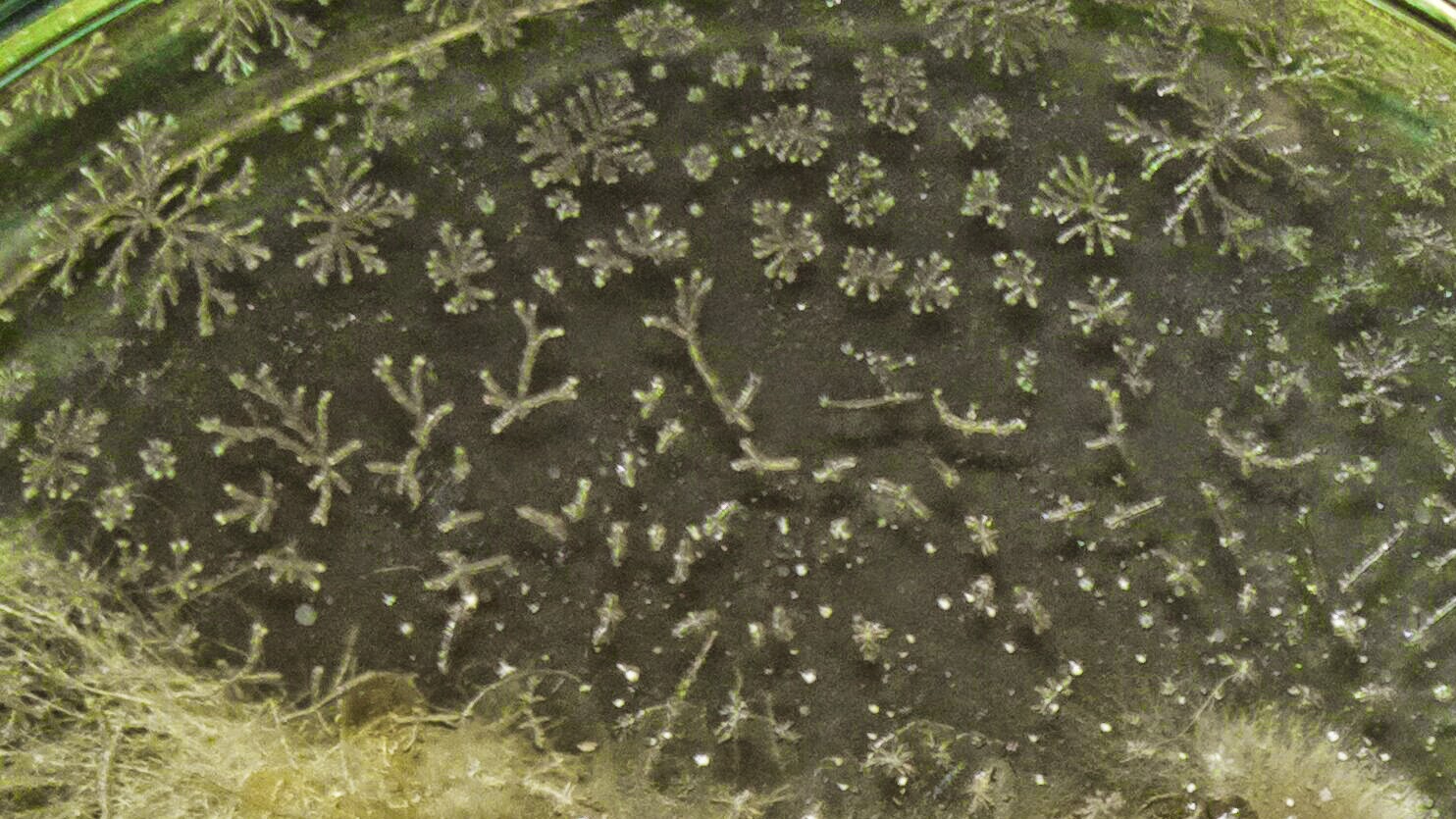 Candida albicans pe mediu de cultura sabouraud cu probe de piele cu ...