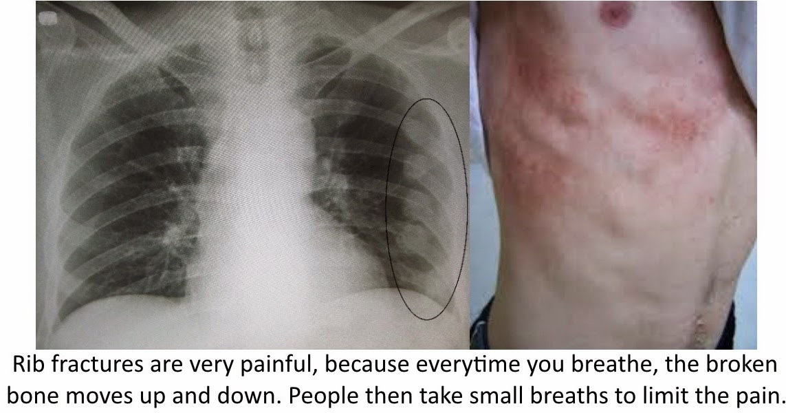 Survival Medicine and Emergency Preparedness ThePrepperPages.com : How ...