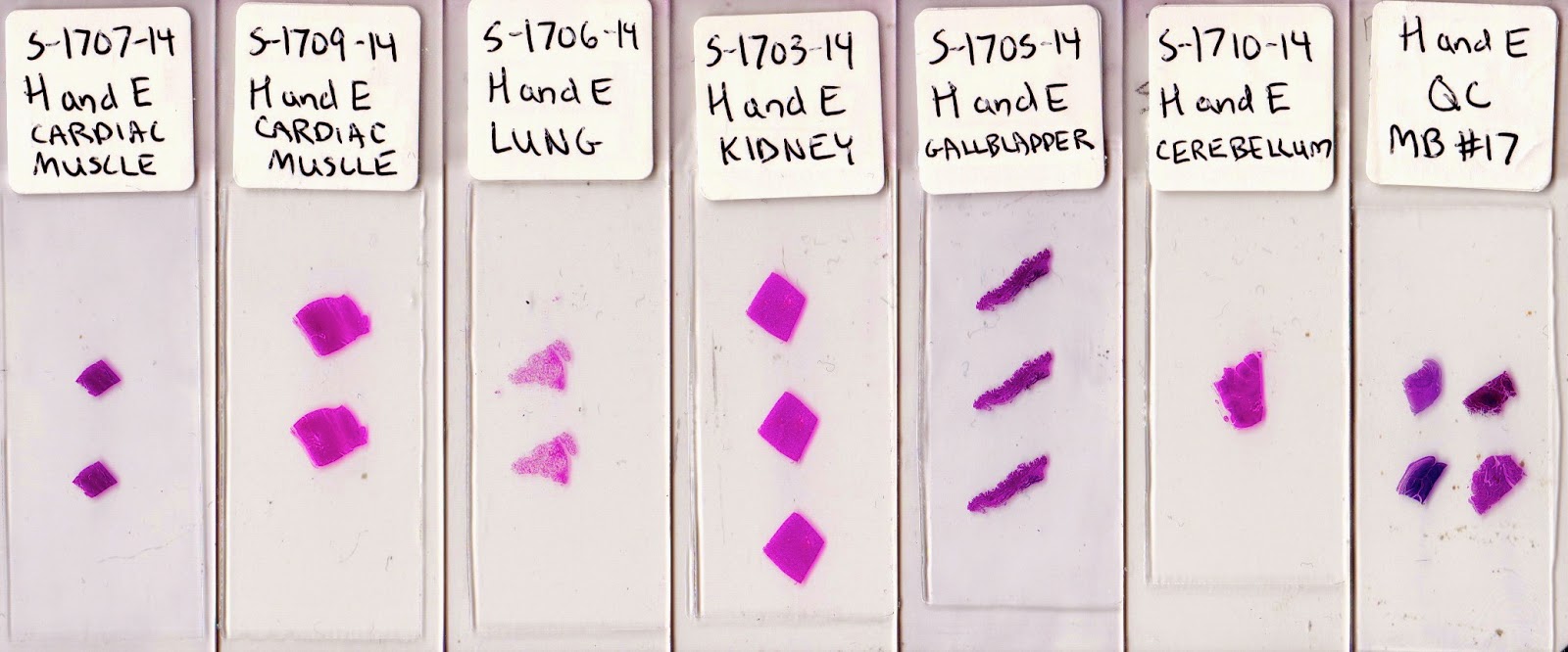 Medical Laboratory Science : Stained Tissues