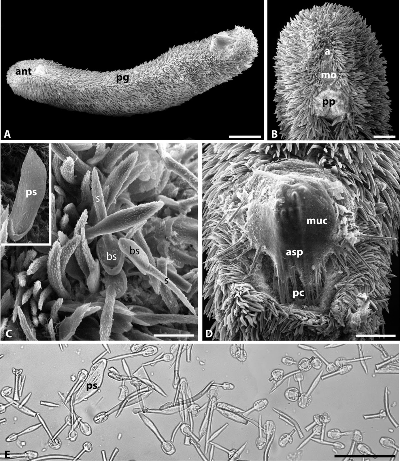 The Aculiferan Hunter: Three new meiofaunal solenogaster species ...