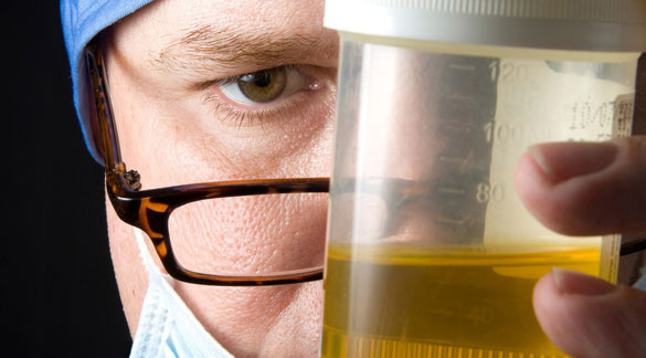 PENGAMBILAN SPECIMEN / SAMPEL URINE | Kampus Kesehatan