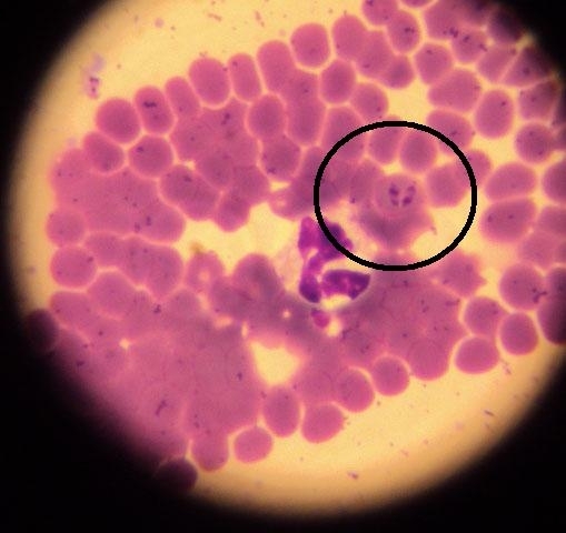 Estudo comparativo entre as técnicas de esfregaços de punção espl?nica ...