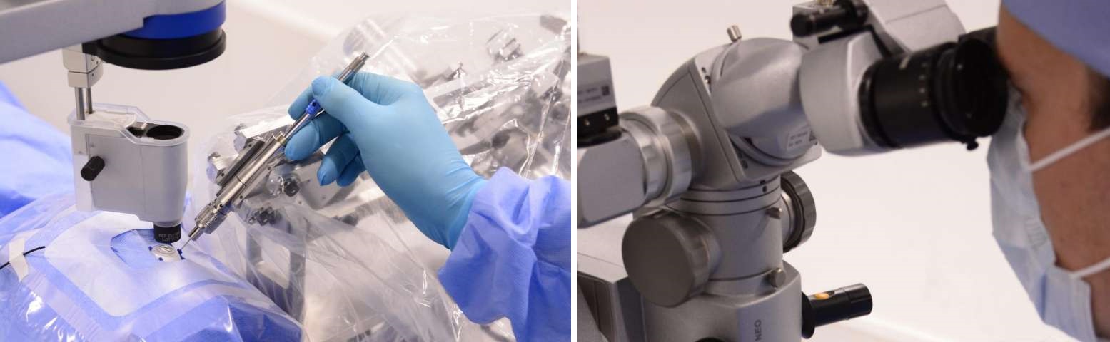 First retina vein occlusion surgery performed with KU Leuven's eye ...