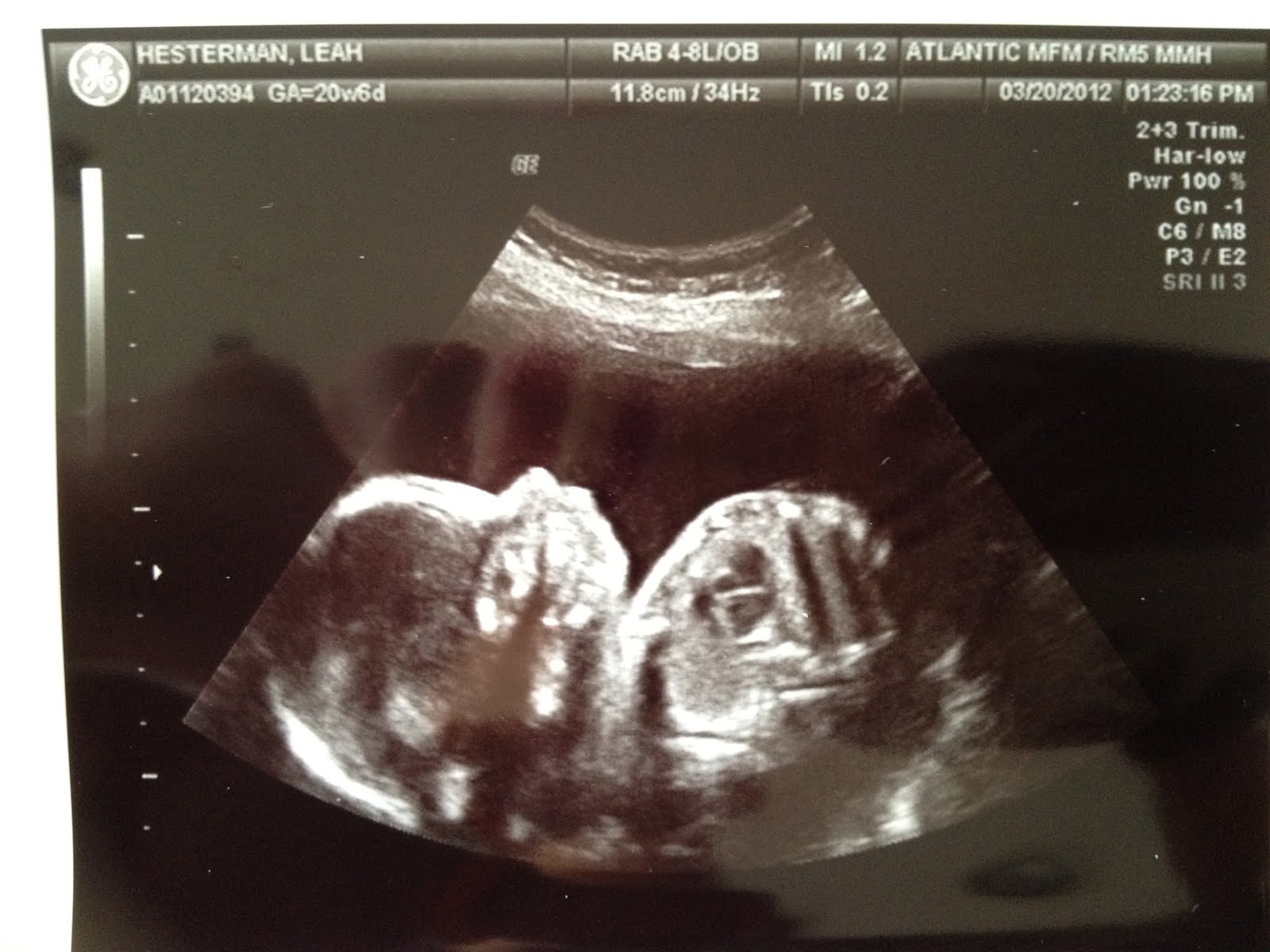 Hestermania!: Ultrasound Pics of Baby #4