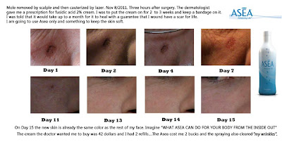 The Redox Molecule Advantage: Learn The New Super Healing Spray From ...