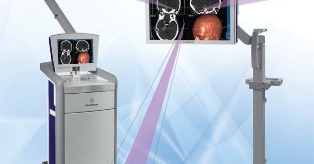 Neurophysiology Plus Iceland: Preoperative Neuronavigation with TMS ...