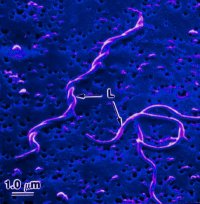 ENFERMEDADES INFECCIOSAS Y MICROBIOLOGIA MEDICA: INFECCIONES POR ...
