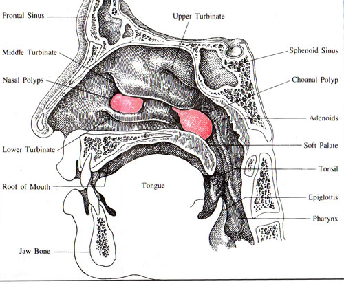DINAR'S: SINUSITIS: GEJALA DAN PENANGGULANGANNYA