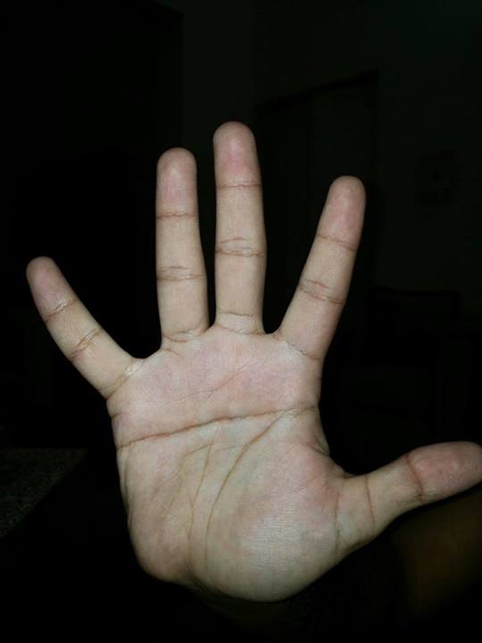 Unusual (Rare Lines & Shapes) Palm Image | INDIAN PALMISTRY ~ INDIAN ...