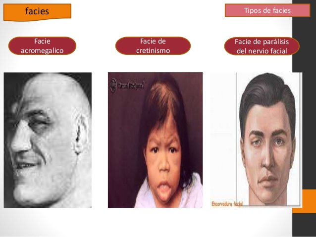 katherine Massiel (semiologia quirurgica): ESTIMACION GENERAL DEL PACIENTE