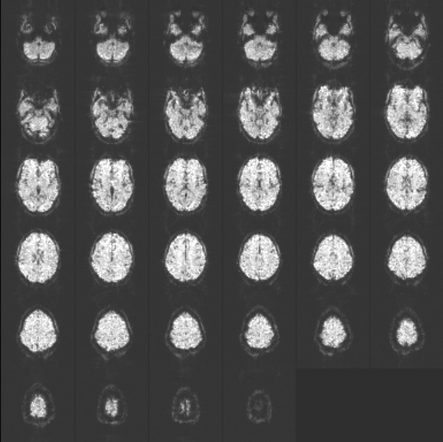 practiCal fMRI: the nuts & bolts: Understanding fMRI artifacts: "Good ...