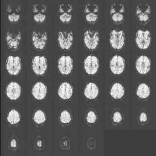 practiCal fMRI: the nuts & bolts: Understanding fMRI artifacts: "Good ...