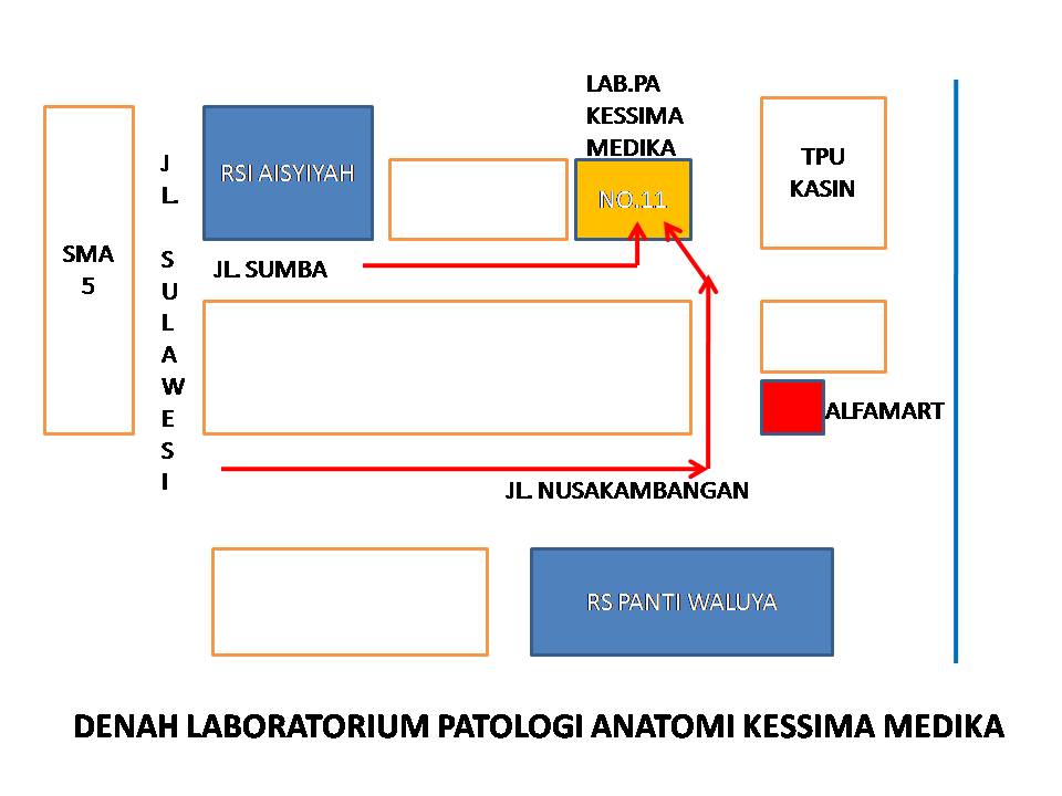 INFORMASI UMUM TENTANG LABORATORIUM PATOLOGI ANATOMI KESSIMA MEDIKA